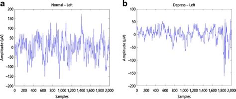 A Comparison Of The Left Prefrontal Eeg Of A Healthy And B Download Scientific Diagram