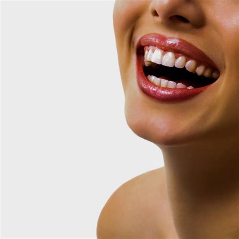 კბილების გათეთრება