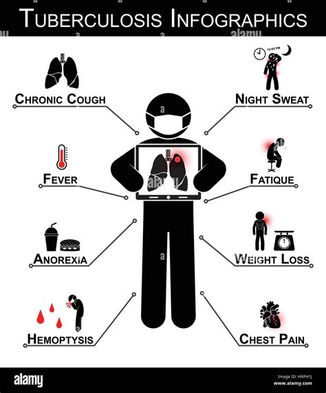 X Ray Tuberculosis Infection Stock Vector Images Alamy