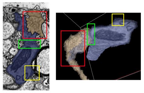 Segmentation Errors Common Errors Of Automatic Segmentation Algorithms