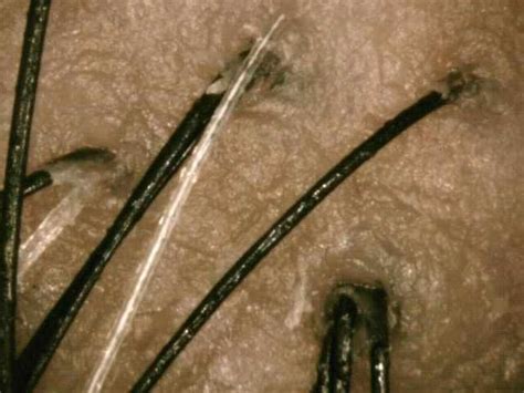 2014 NEW 5 0 MP USB Hair Scalp Scope Hair Diagnosis Hair Scalp Camera