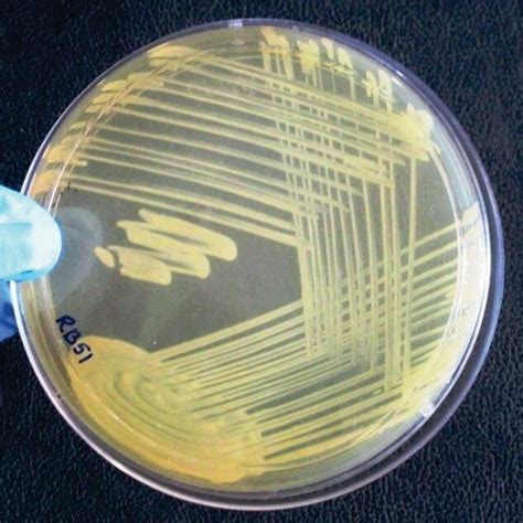 B Culture Of Brucella Abortus Strain Rb51 Organisms Download