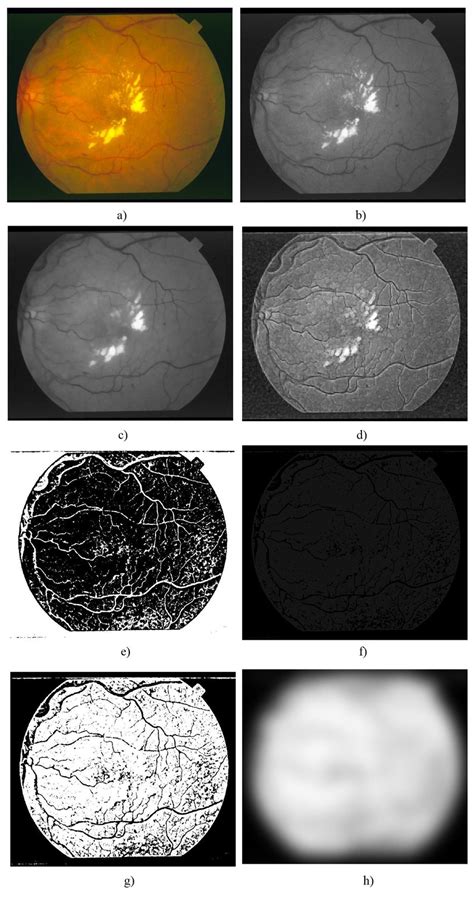 Proposed Feed Output I Minimums Between G And H J Gaussian Download Scientific