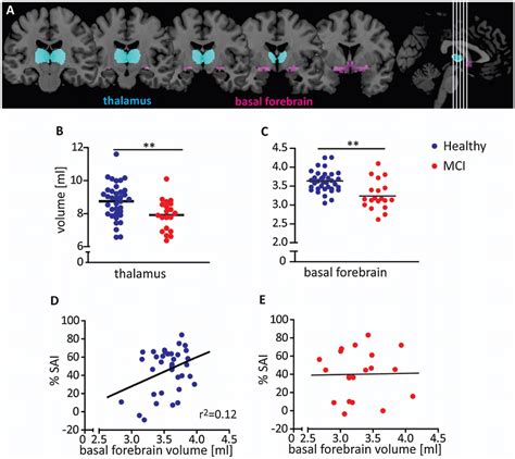 A Anatomic Representation Of The Basal Forebrain Cholinergic System Download Scientific