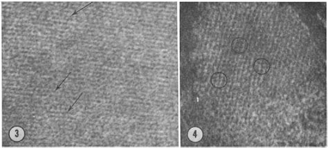 Figure 3 From The Presence Of A Crystalline Matrix In Pyrenoids Of The Diatom Achnanthes