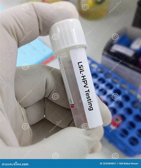 Vaginal Fluid Sample For LSIL HPV DNA Test Stock Image Image Of Fluid Genital 303984851