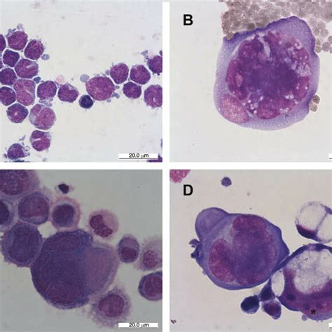 Cell Populations Of A Normal And Activated CSF Cell Picture A Normal Download Scientific