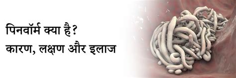 पिनवॉर्म Pinworm क्या है लक्षण कारण और इलाज Pinworm संक्रमण और उपचार