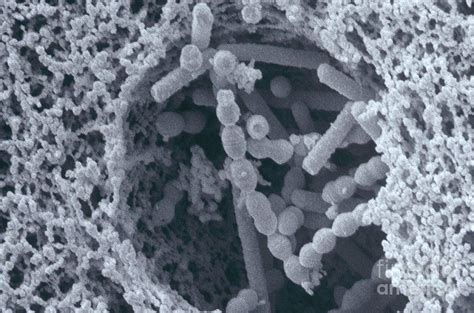 Bacteria In Yogurt Compound Microscope Yogurt Under The Microscope
