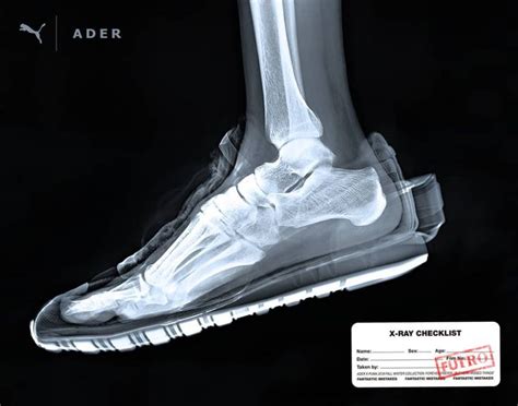 A D E R ader error Instagram 照片和视频 Brand collaboration Ader