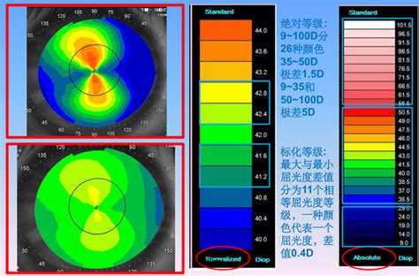 关于角膜地形图您了解多少一文教你学会看角膜地形图 知乎