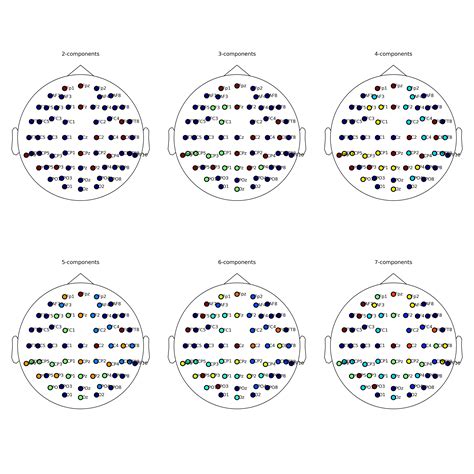 Optimal Selection Of Delay And Embedding Dimension For Eeg Complexity