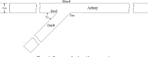 Figure 1 From Numerical Simulations Of Pulsatile Flow In An End To Side Anastomosis Model