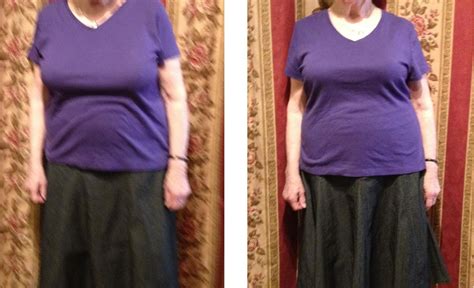 Before After Bella Intimates