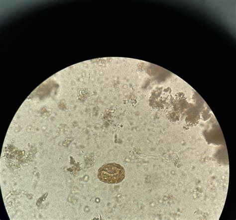 Evaluasi Model Segmentation Instance Segmentation Dataset By