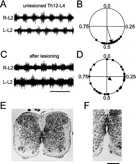 Leftright Alternation Depends On An Intact Ventral Commissure A B Download Scientific