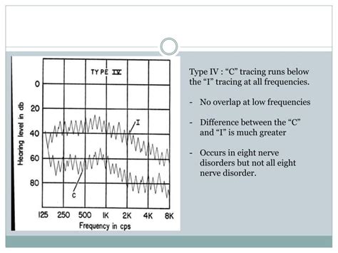 Bekesy Audiometry Pptx