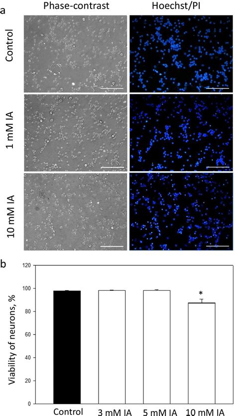 Effect Of Itaconic Acid On Neuronal Cell Viability In Cgc Cultures A Download Scientific