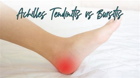 Achilles Tendinitis Vs Bursitis What Is The Difference Anf Academy