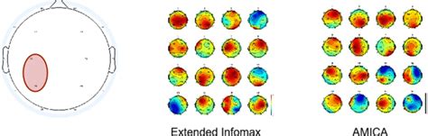 Comparison Between Extended Infomax And Amica For Decomposing The Eeg Download Scientific