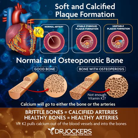 Vitamin K2 Benefits For Heart Bones Hormones And More