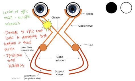 Neuro Exam 3 Flashcards Quizlet