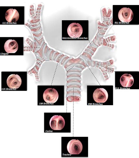 Single Lung Ventilation At Starship