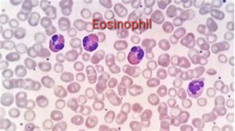 Pbf Peripheral Blood Film Whatsapp Status For Lab Technologist 🔬🔬