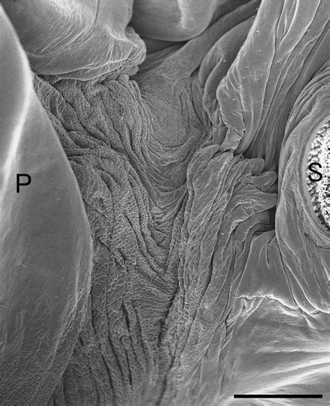 Lack Of Trichoid Hairs In The Intersegmental Membrane Of The Abdomen Download Scientific