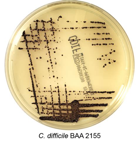Clostridium Difficile Agar