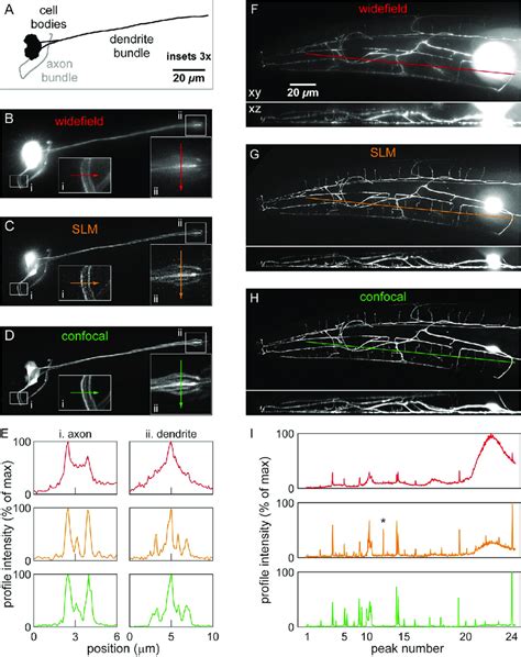 In Vivo Imaging Of Fluorescent Neurons In C Elegans A Line Drawing Download Scientific