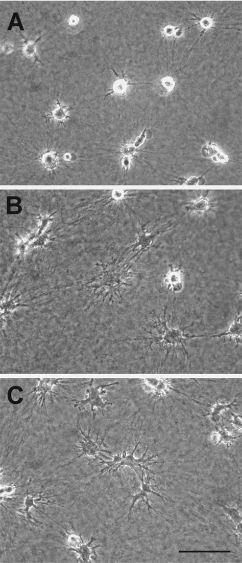 Morphologies Of Rpe Cell Contracting Collagen Matrices Under The Download Scientific Diagram