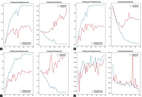 Deep Learning For Image Classification Between Primary Central Nervous System Lymphoma And