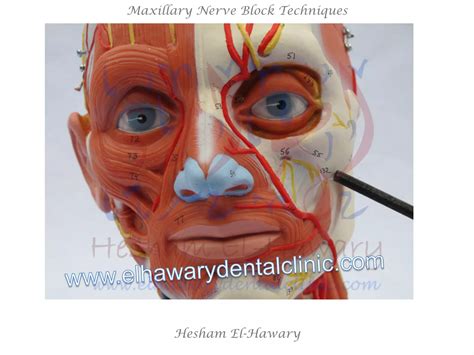 Maxillary Nerve Block Anesthetic Technique With Photos Pdf Ear Nose And Throat Conditions