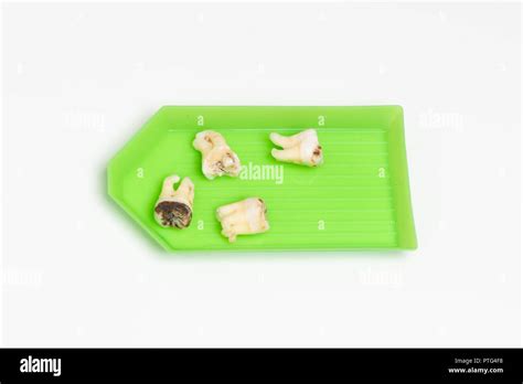 Pulled Out Bad Molars Human Teeth Close Up On White Background Stock