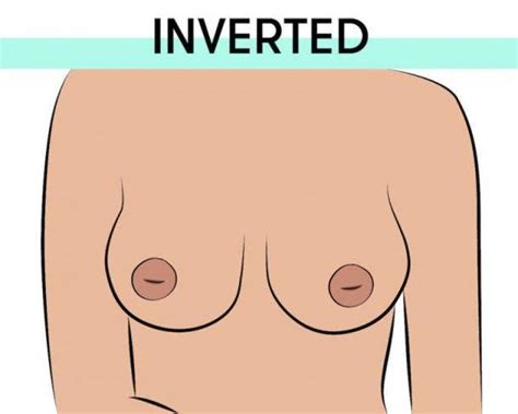 There Are Only 8 Types Of Nipples In The World — Which Kind Do You Have