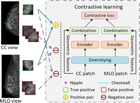 Illustration Of Multi View Mass Matching Contrastive Learning Scheme Download Scientific