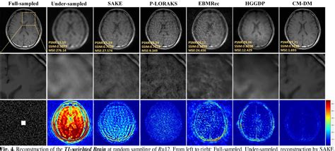 Figure From Correlated And Multi Frequency Diffusion Modeling For Highly Under Sampled MRI