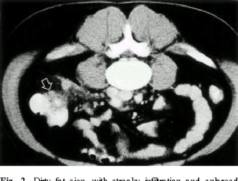 Figure 1 From Pylephlebitis Associated With Appendicitis Semantic Scholar