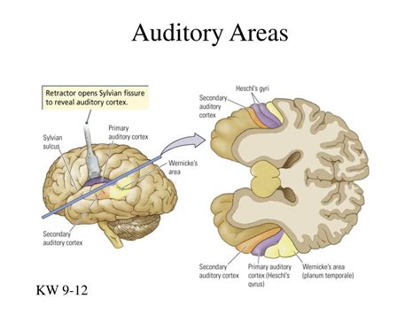 Visual And Auditory Cortex Function Iumtros