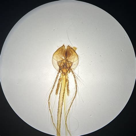 Organism Under Microscope R Microscopy