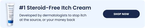 Lupus Rash Vs Rosacea Understanding Malar And Butterfly Rashes Dermeleve®