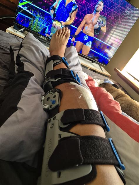 Ruptured My Patella Tendon After Picking Up Footballsoccer For The First Time Rtvtooclose