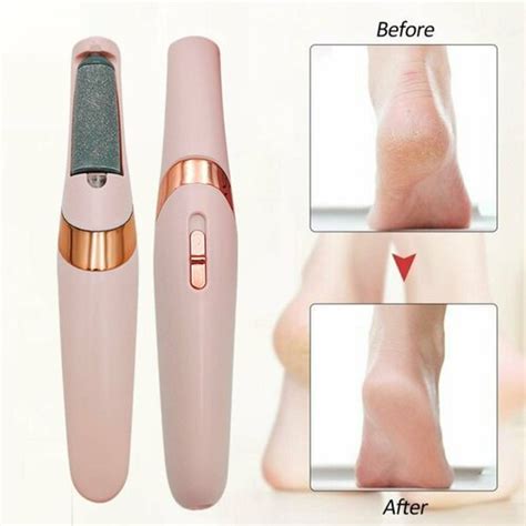 Электрическая пилка для пяток Pedicure Tool с подсветкой, беспроводная ...
