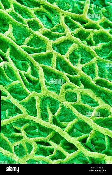 Gallbladder Surface Coloured Scanning Electron Micrograph Sem The Columnar Epithelium Of The