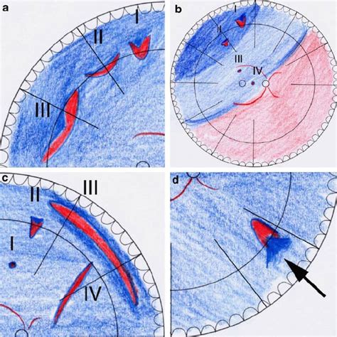 Flowchart Of All Fundus Drawings Of The Year 2000 Eight Drawings Were