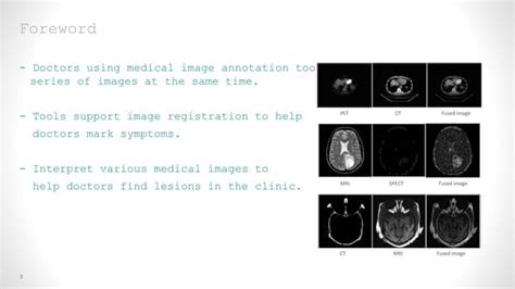 Image Registration By Using Simpleitk Pptx