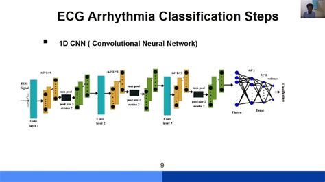 Ecg Arrhythmia Classification Using 1 D Cnn Youtube