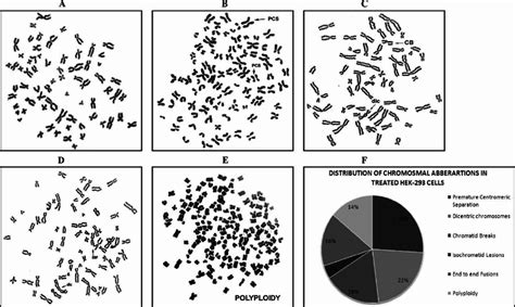 Structural Chromosomal Aberrations Representative Metaphase Spreads Of Download Scientific