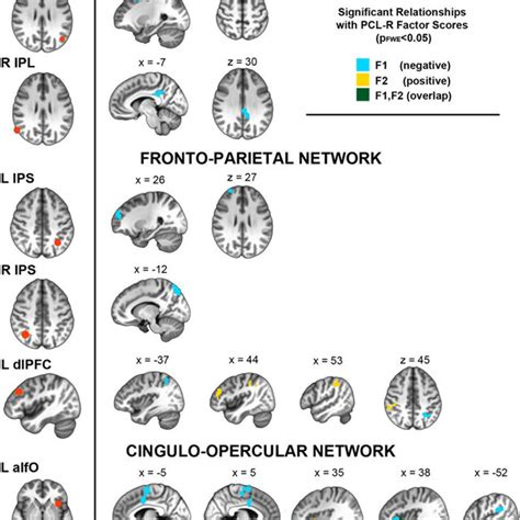 Distinct Patterns Of Functional Connectivity For Pcl R Factor Scores Download Scientific